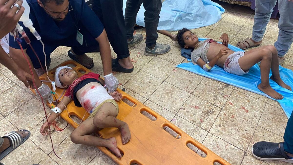 Pelo menos 21 mil crianças ficaram com deficiências durante a guerra - JN