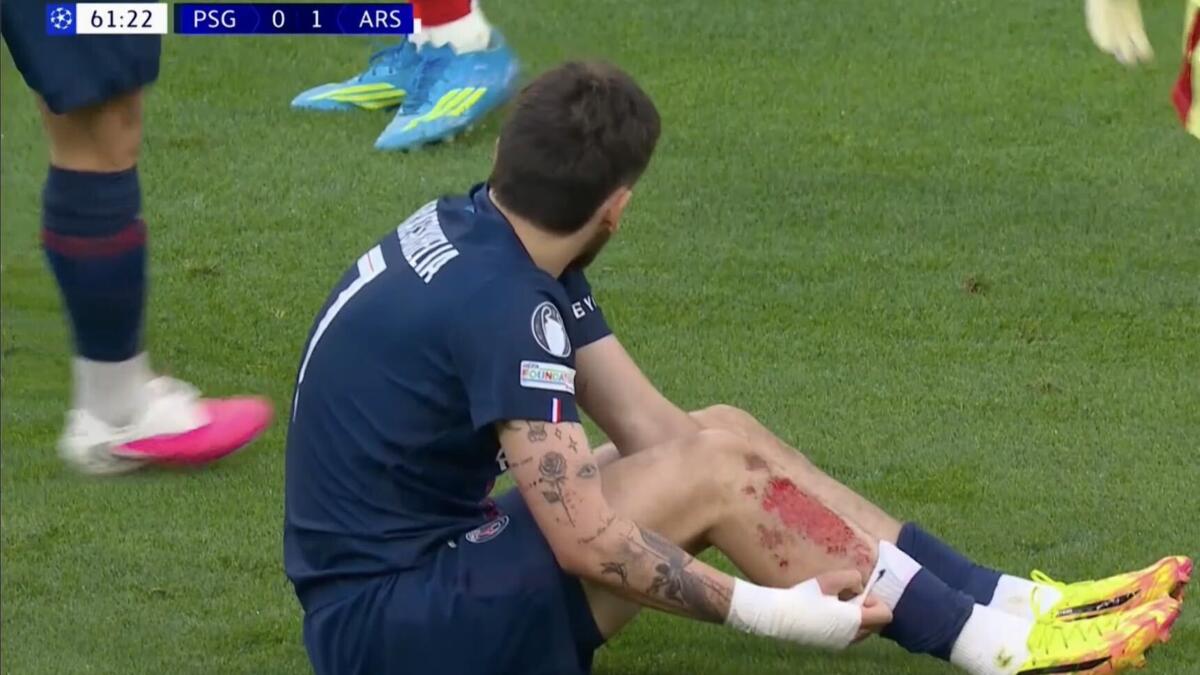 O estado da perna direita de Khvicha Kvaratskhelia na final da Liga dos ...